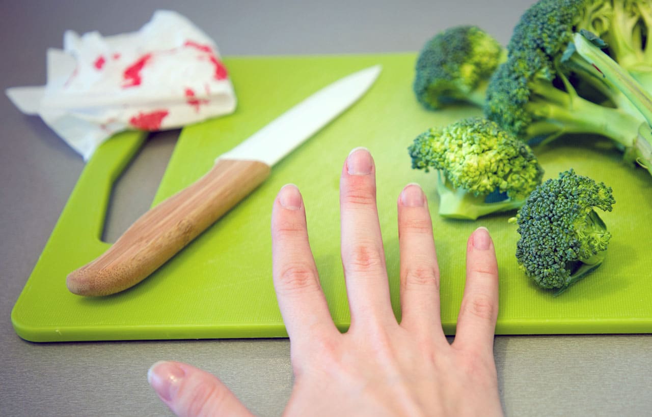 Primeros Auxilios ante una Herida Sangrante: Cómo Actuar Rápida y ...